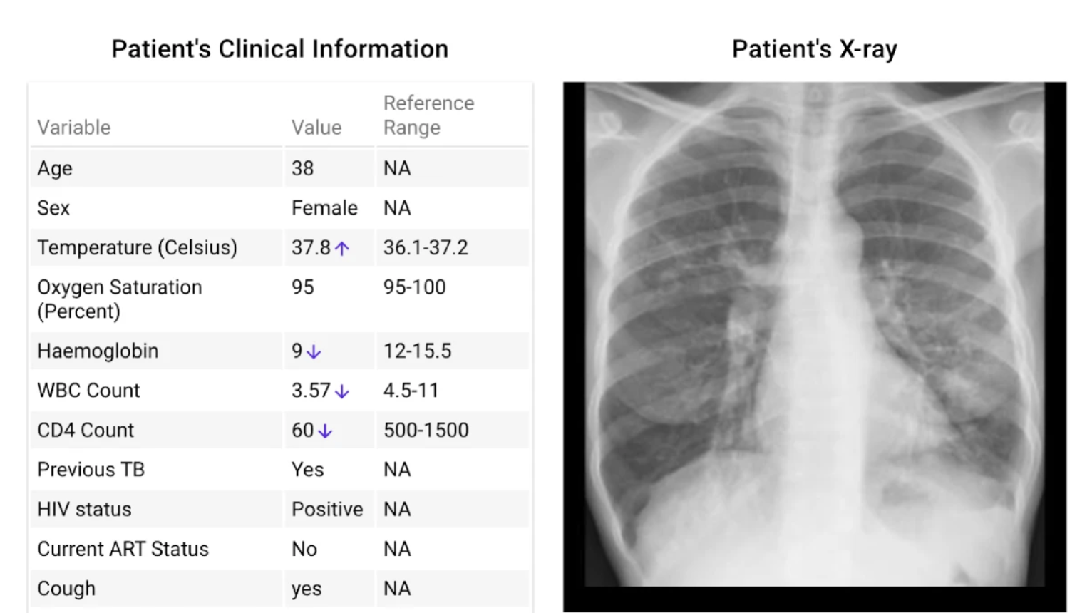 Sepsis Risk Assessment